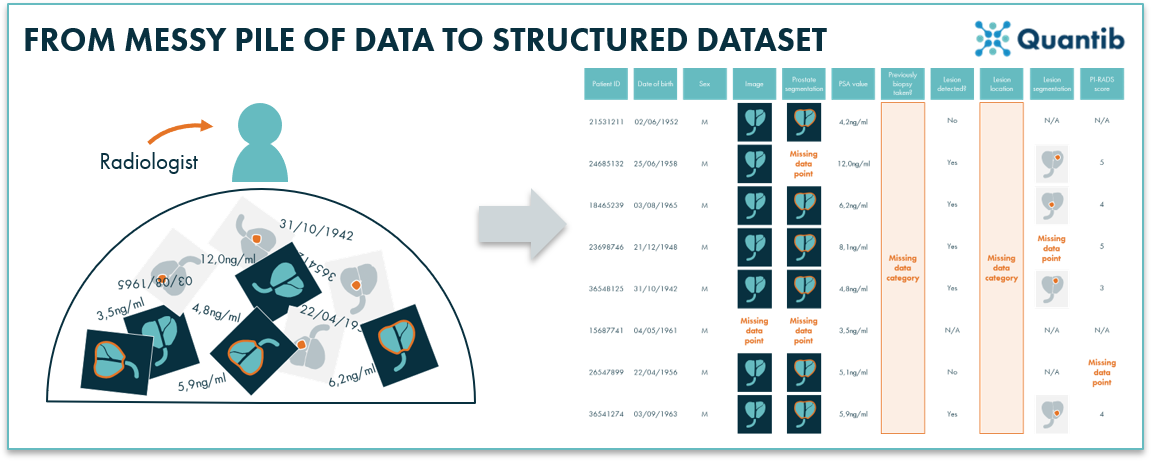 How to build your own algorithm: cleaning the AI radiology data